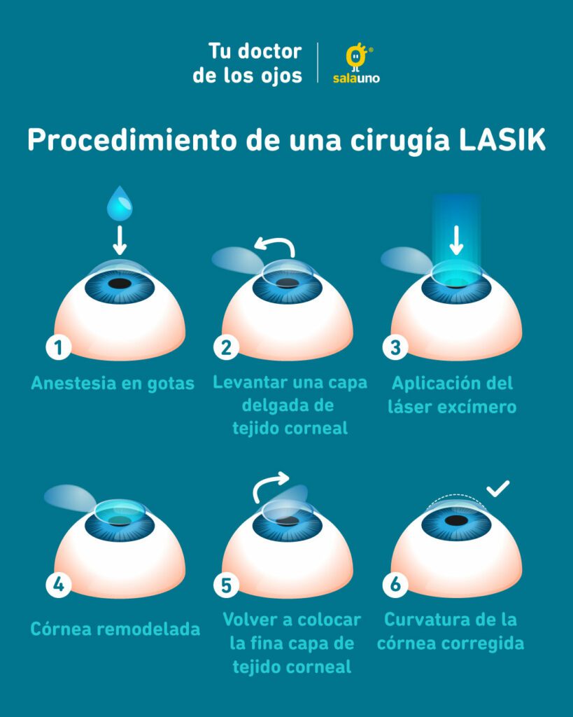 LASIK: Cirugía Láser, dile ¡adiós a los lentes! - salauno